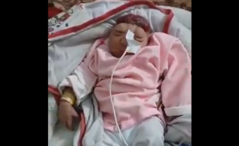 Born Into Horror: Gaza Baby Without Brain Sparks Fears Over Toxic ...